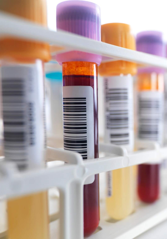 Best Pathology Labs India | Diagnostic Centre | Blood Testing Home ...